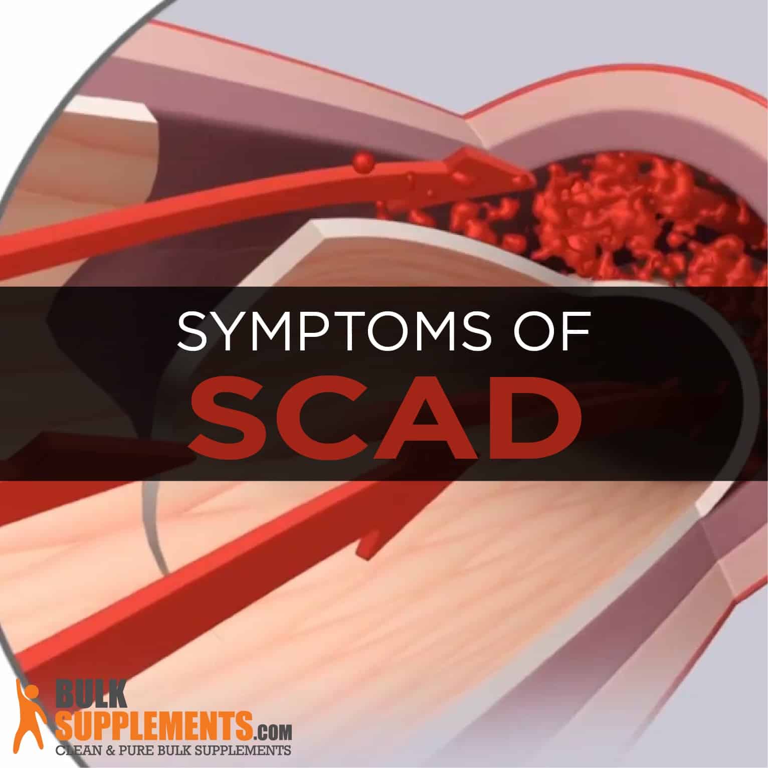 Spontaneous Coronary or Carotid Artery Dissection (SCAD): Causes ...